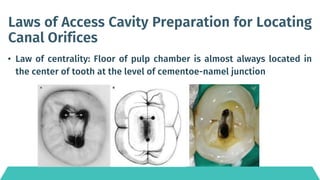 Principles of Access cavity preparation.pptx