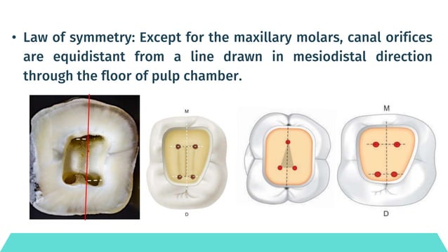 Principles of Access cavity preparation.pptx | Dental Health | Diseases ...