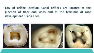 Principles of Access cavity preparation.pptx