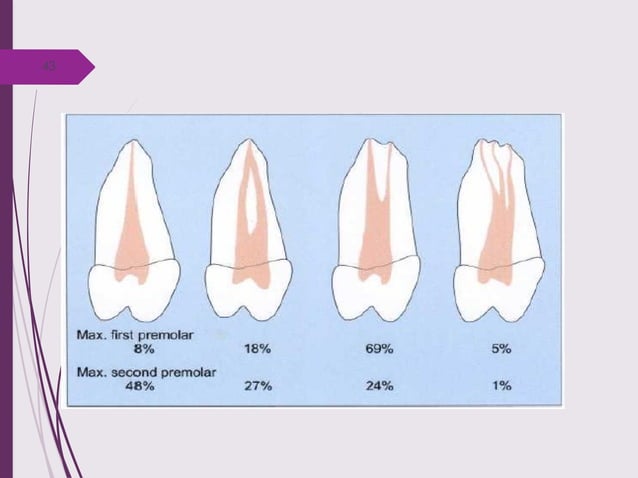 access cavity preparation and anatomy of pulp | PPT