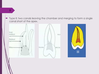access cavity preparation and anatomy of pulp | PPTX