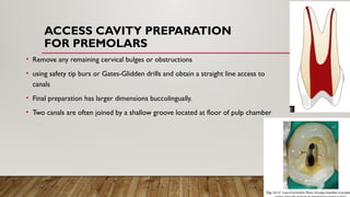 Access Cavity Preparation (2).pptxin endodontic | PPTX