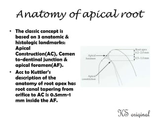 Access cavity preparation for maxillary canines | PPTX