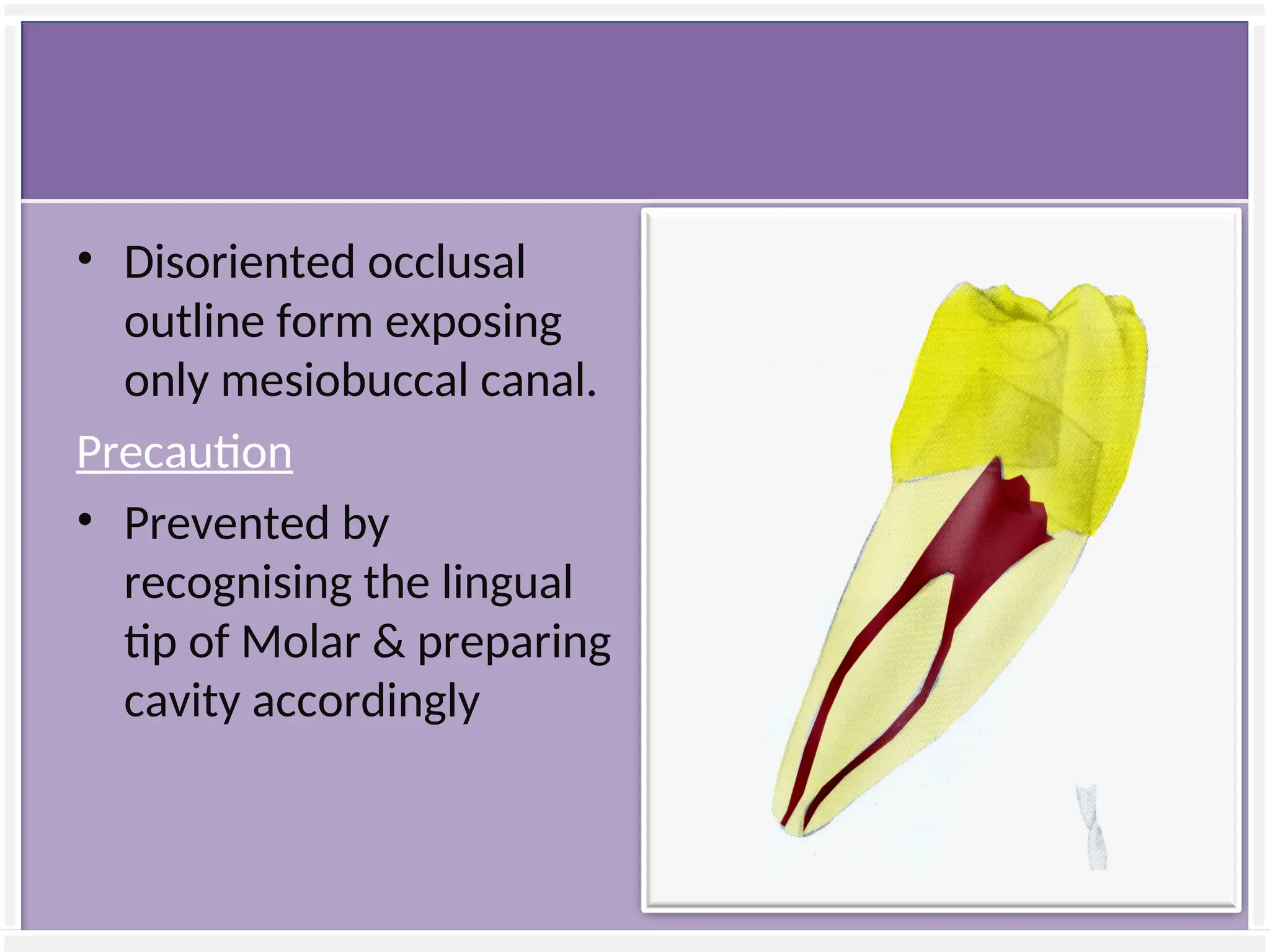 Endodontic access cavity preparation design | PPT