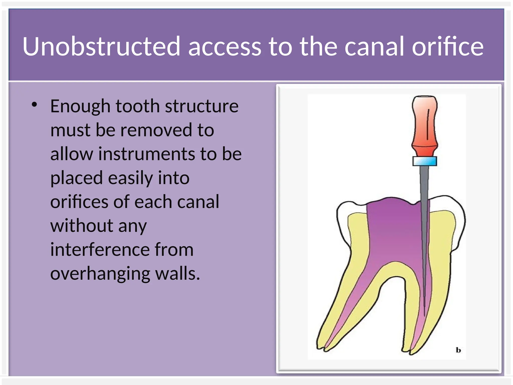 access cavity preparation and design features | PPT