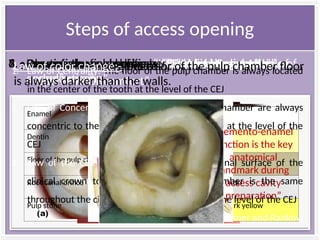 access cavity preparation and design features | PPT