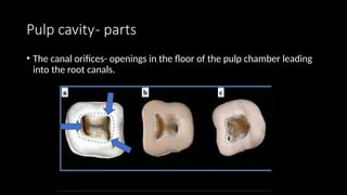 access opening & anatomy of root canalss | PPTX