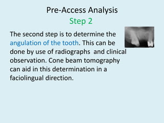 Access opening for RCT | PPTX