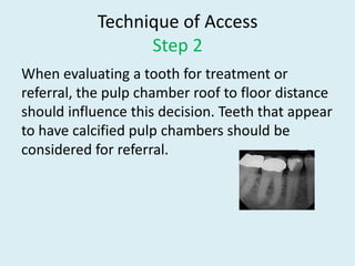 Access opening for RCT | PPTX