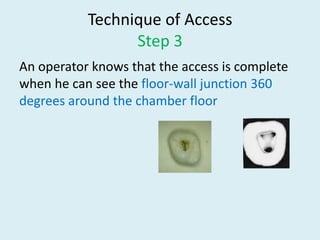 Access opening for RCT | PPTX