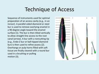 Access opening for RCT | PPTX