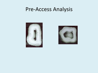 Access opening for RCT | PPTX