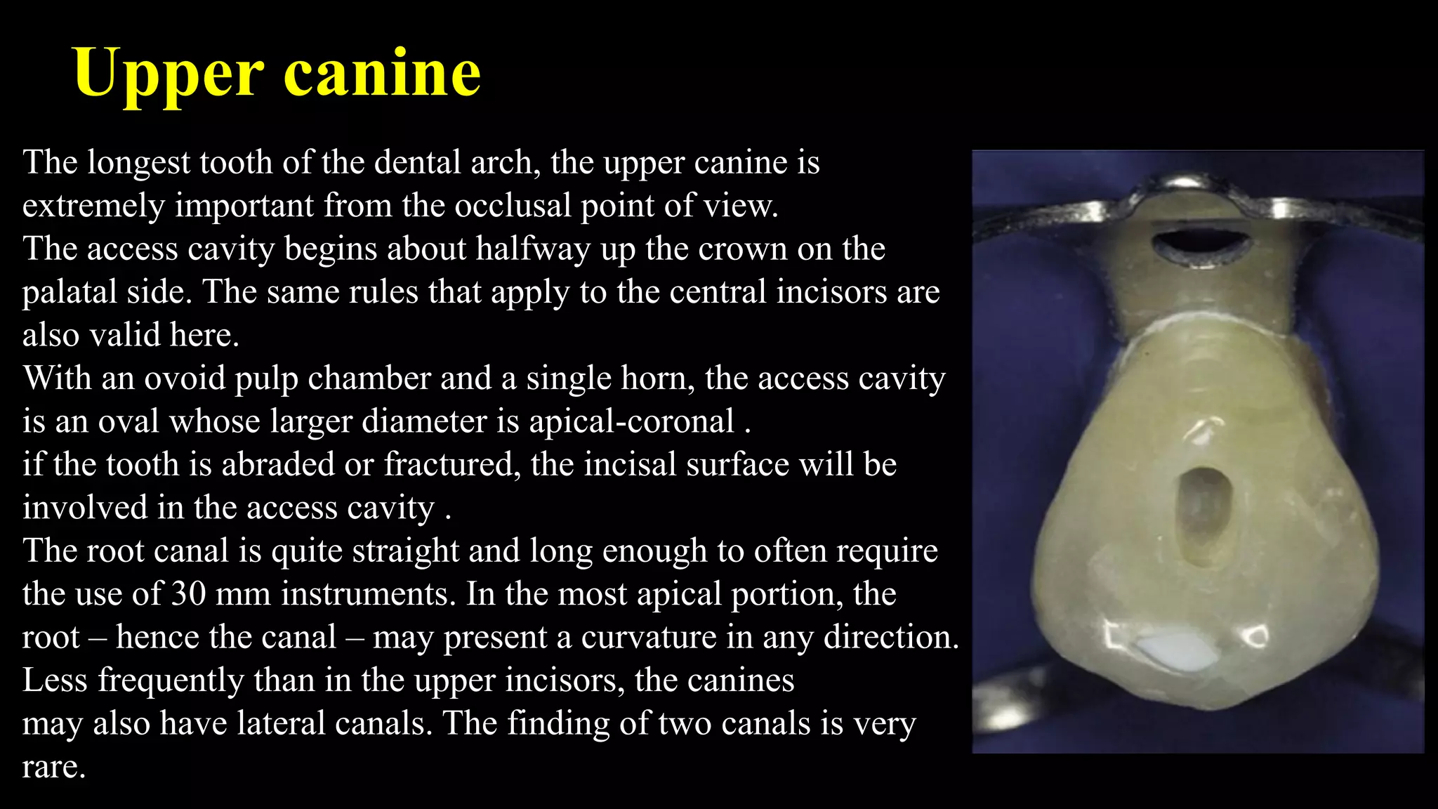 Access opening in anterior teeth | PDF