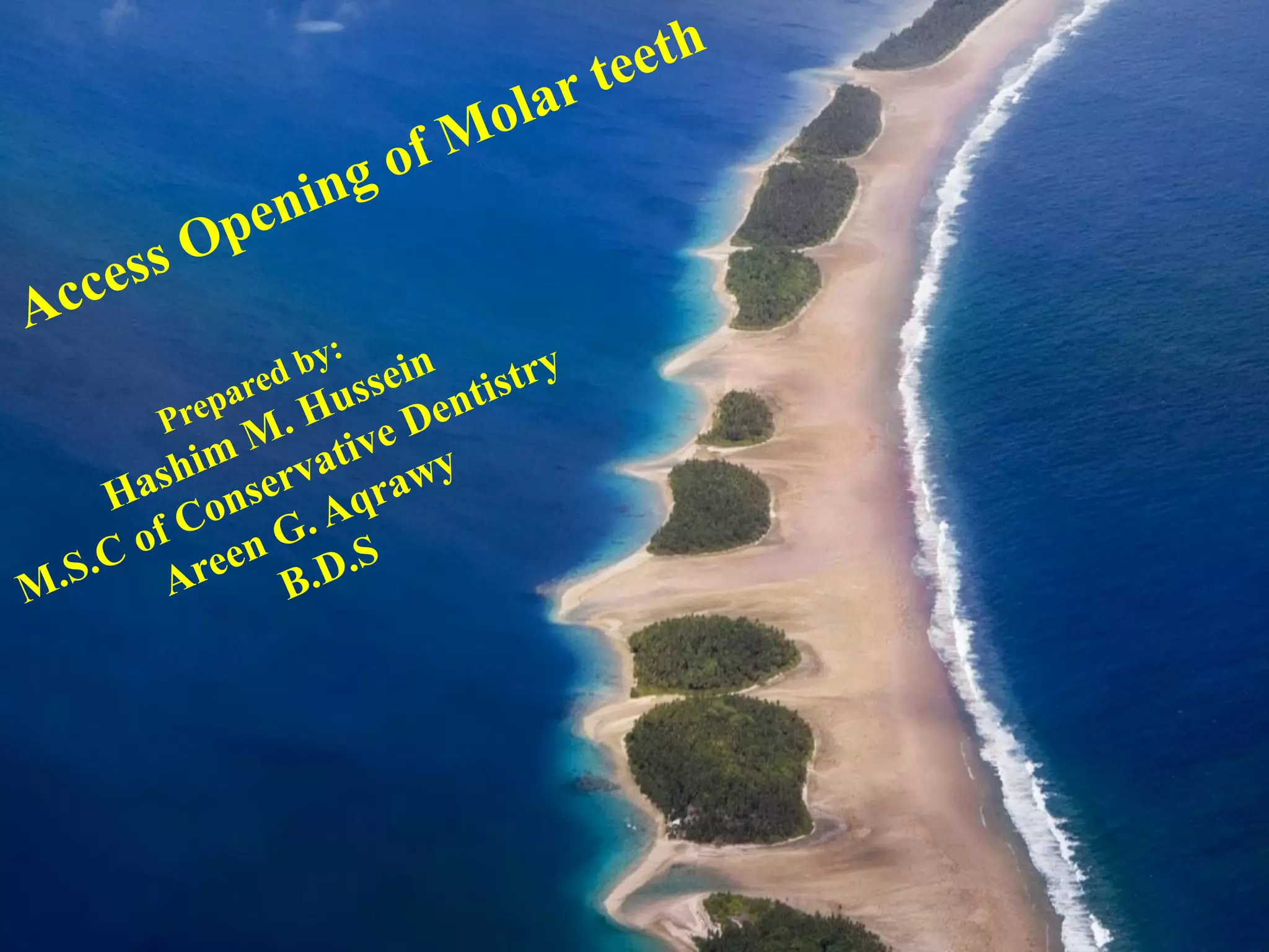 Access opening of molar teeth | PDF