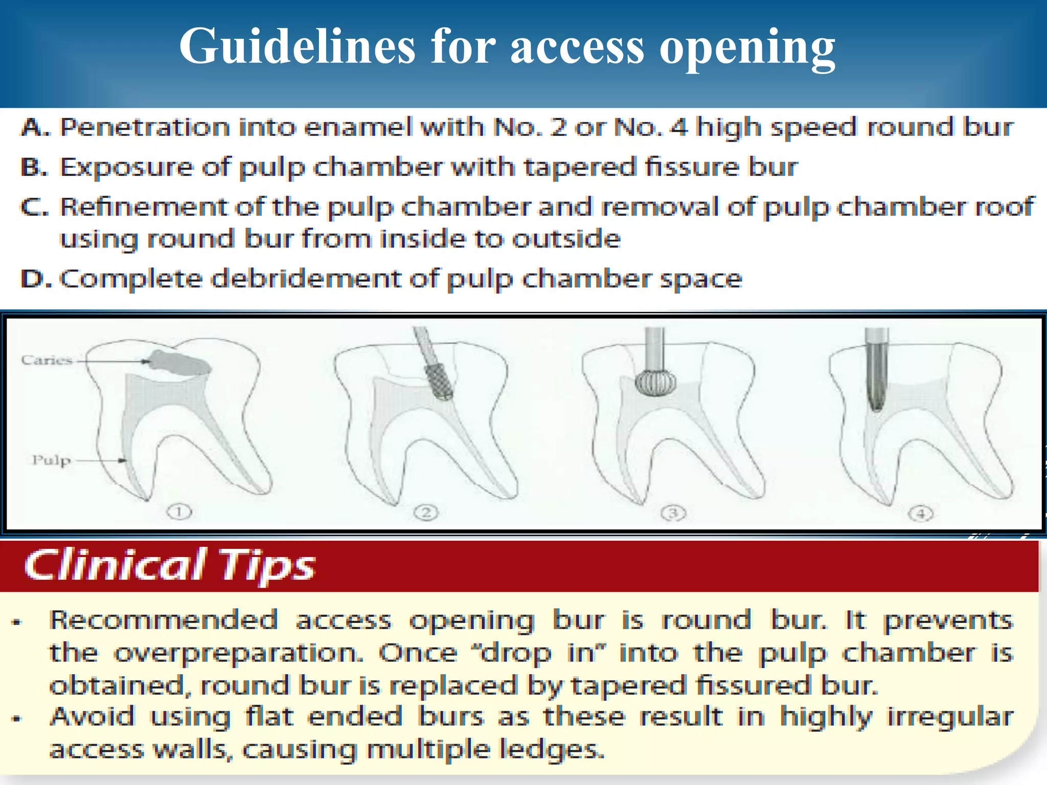 Access opening of molar teeth | PDF