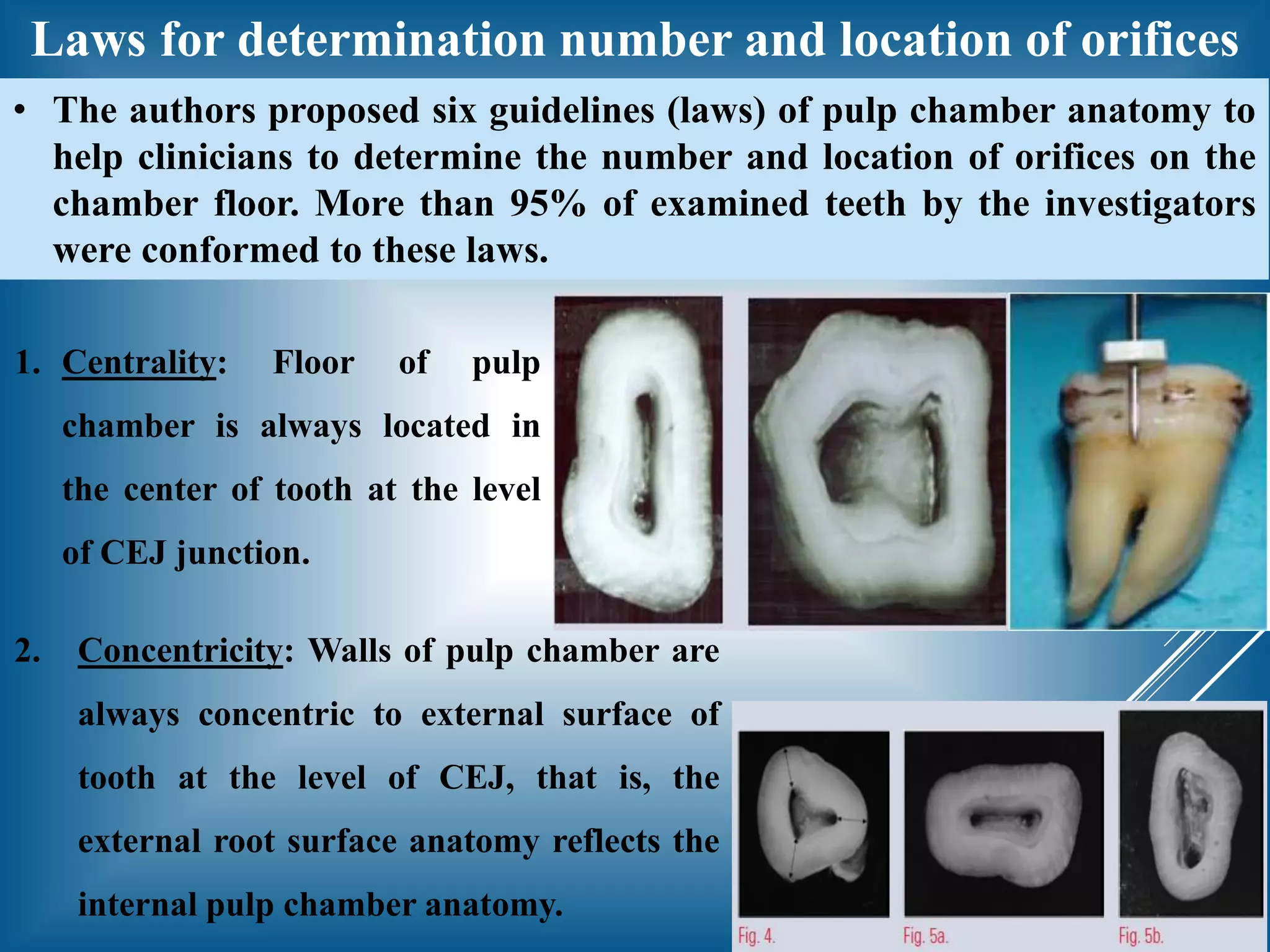 Access opening of molar teeth | PDF