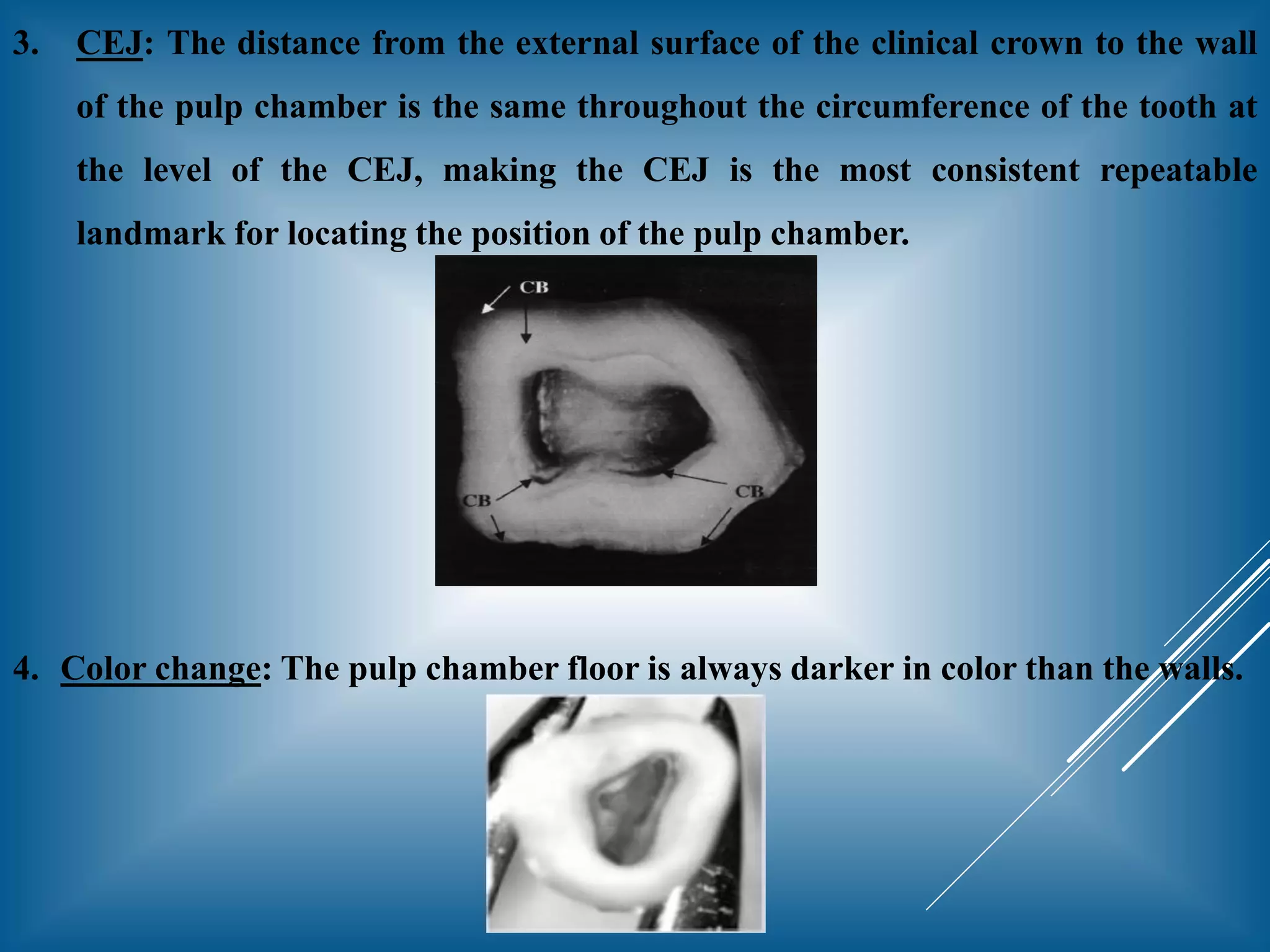 Access opening of molar teeth | PDF