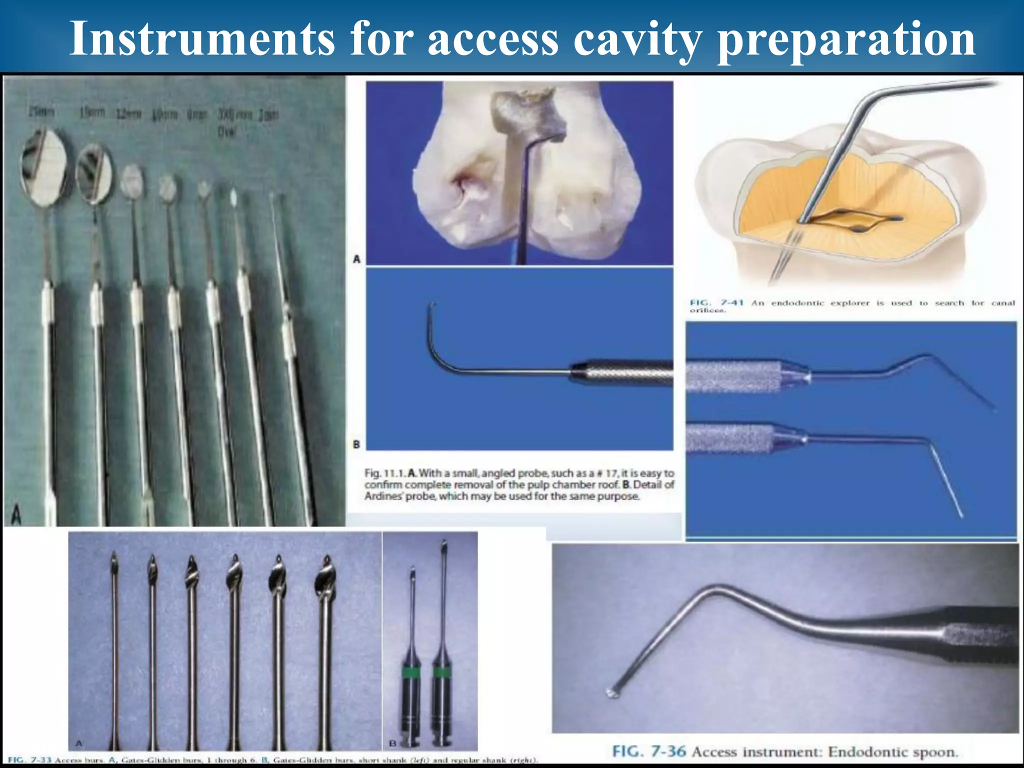 Access opening of molar teeth | PDF