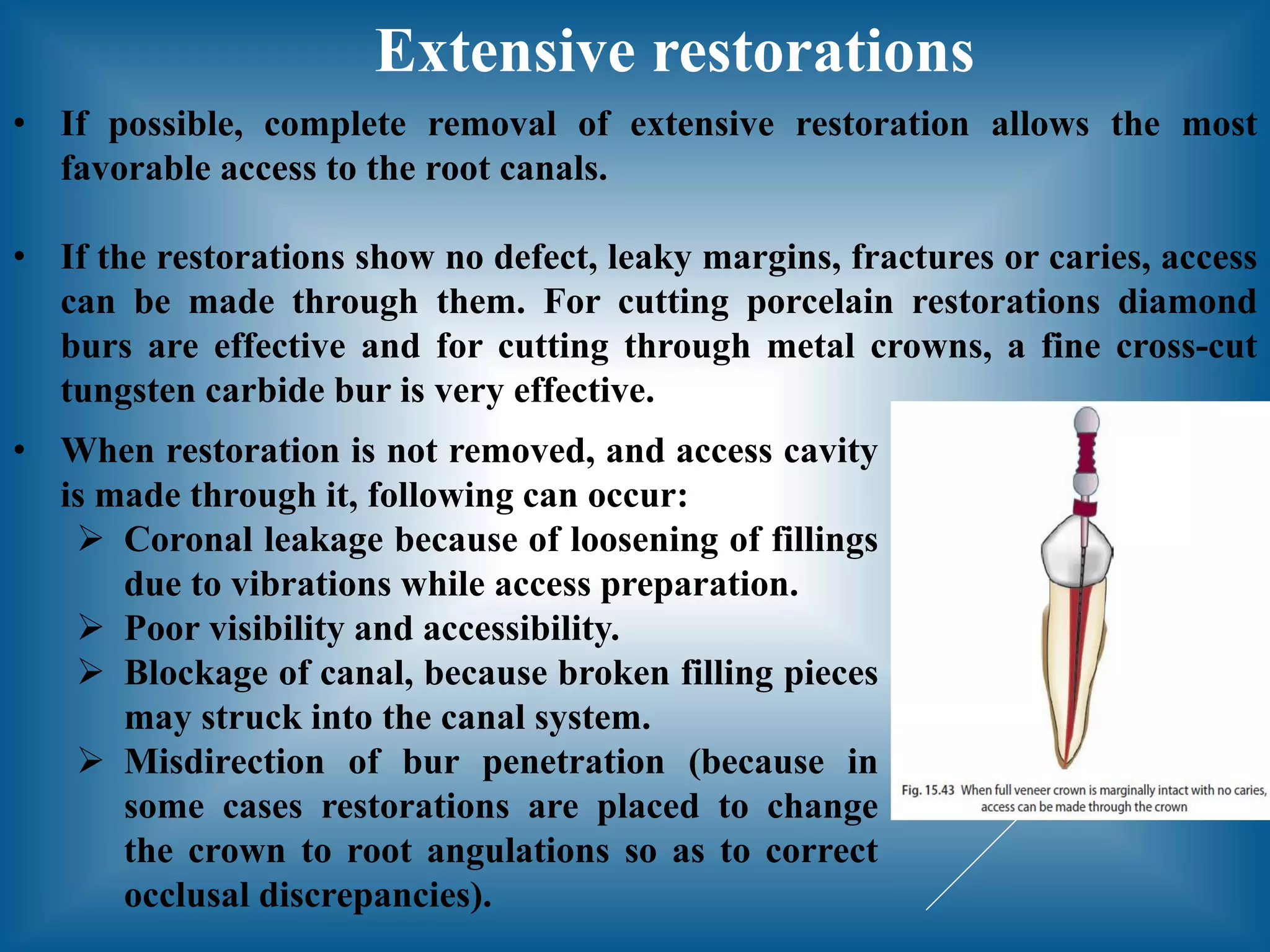Access opening of molar teeth | PDF