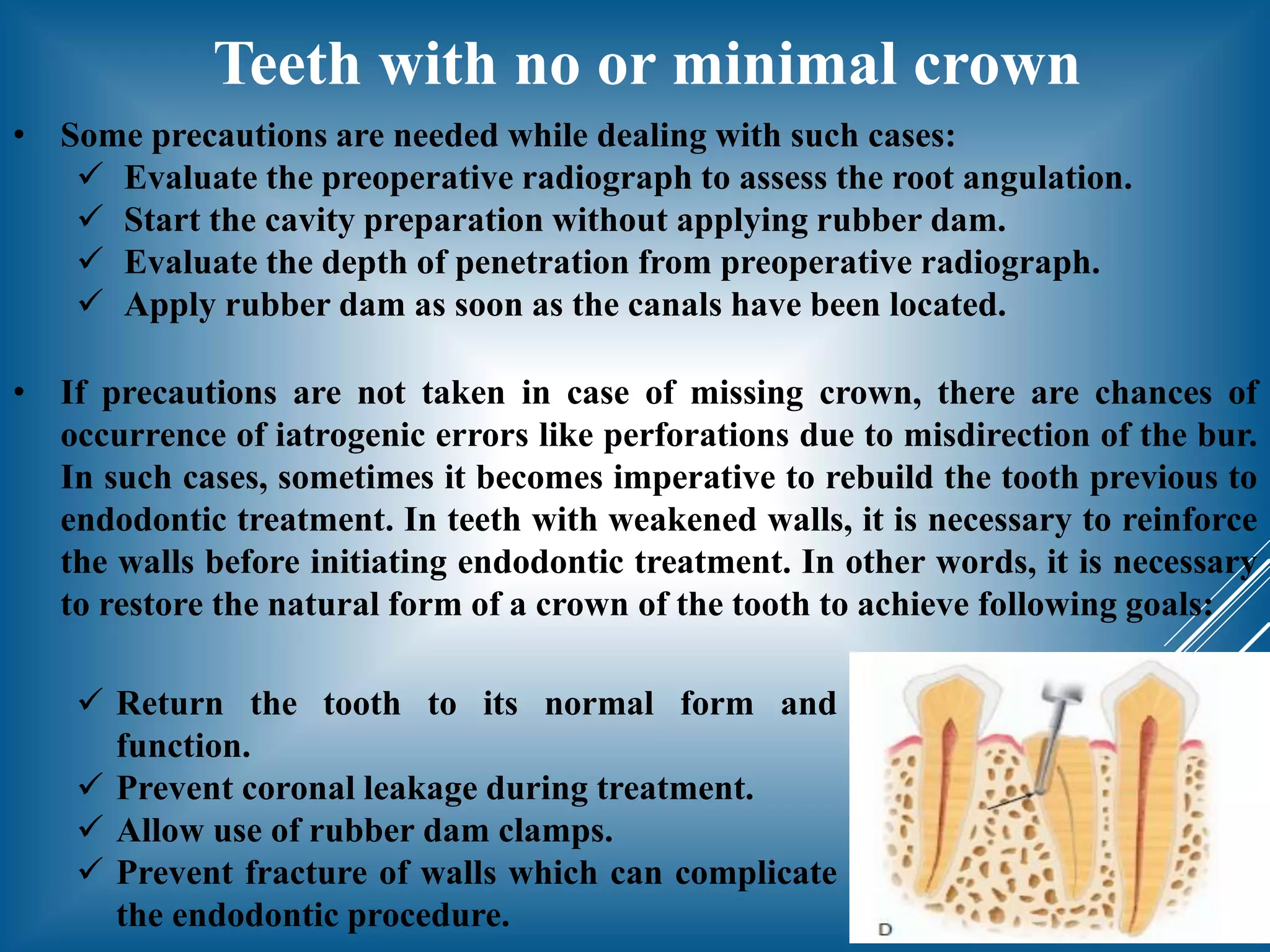 Access opening of molar teeth | PDF