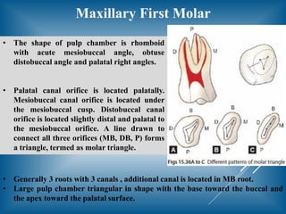 Access opening of molar teeth | PDF