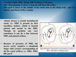 Access opening of molar teeth | PDF