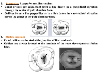 access opening of molar teeth-shivangi.pptx