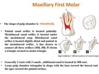 access opening of molar teeth-shivangi.pptx