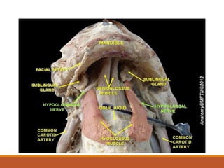 Hypoglossal Nerve Cadaver