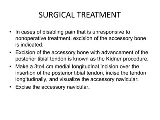 Accessory navicular | PPTX
