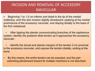 Accessory navicular | PPTX