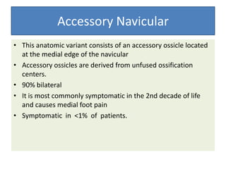 Accessory navicular | PPTX