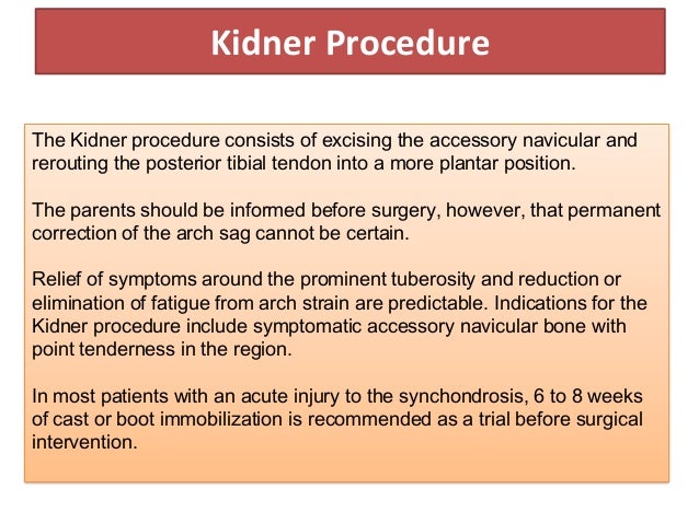 Accessory navicular
