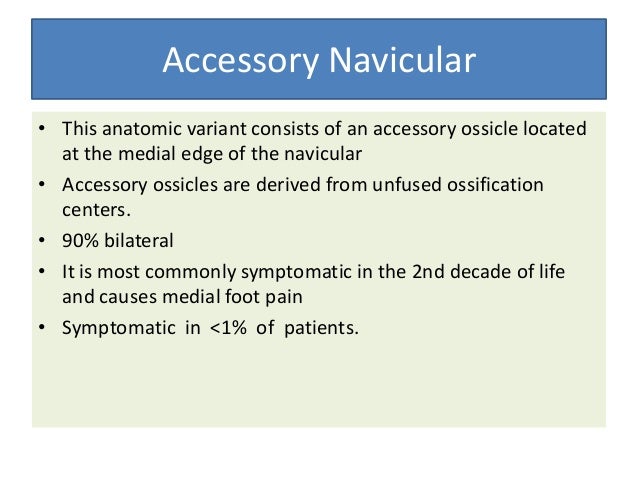 Accessory navicular