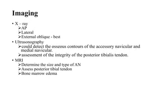Accessory Navicular Bone.pptx