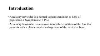 Accessory Navicular Bone.pptx