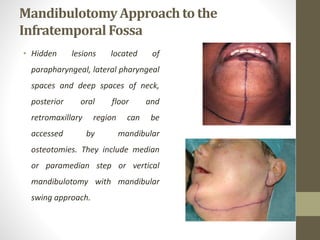 Access osteotomy | PPTX