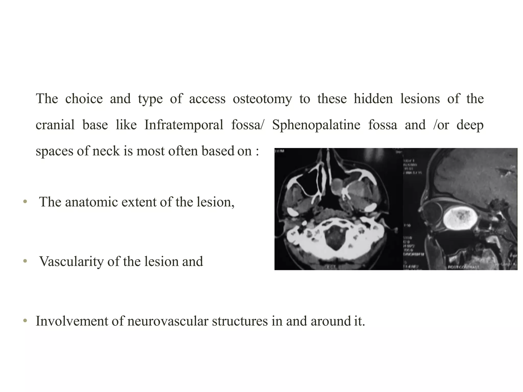 Access osteotomies in oral & cranio-maxillofacial surgery | PPTX