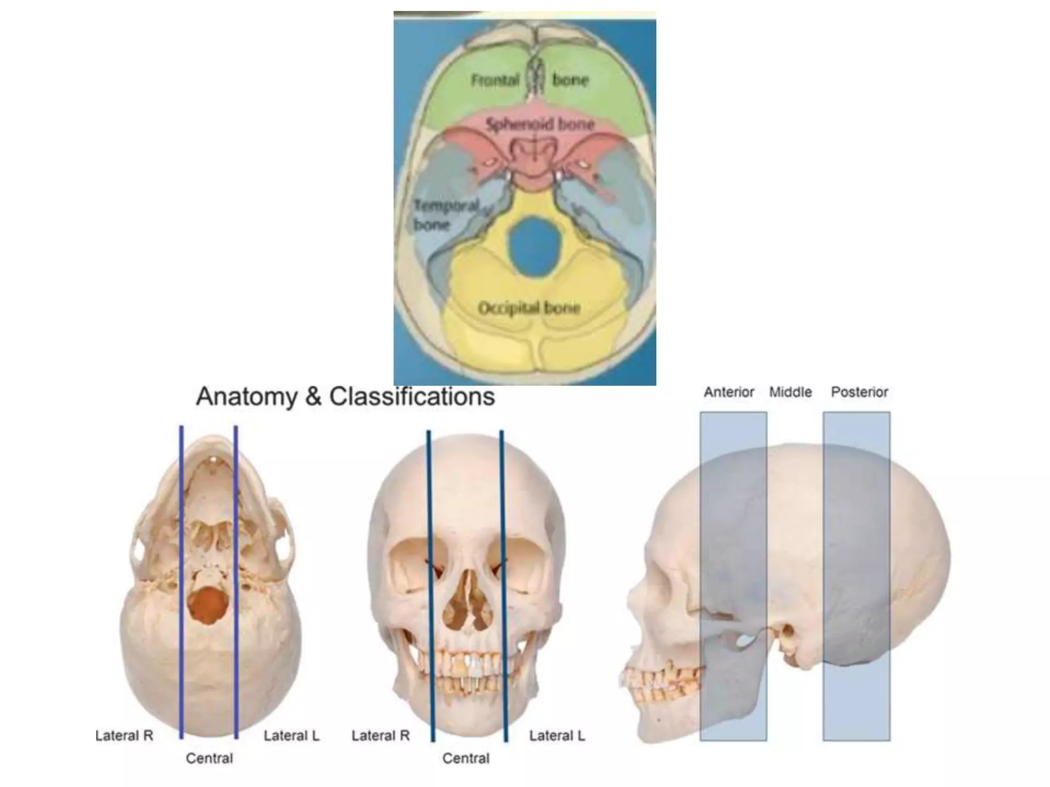 Access osteotomies in oral & cranio-maxillofacial surgery | PPTX
