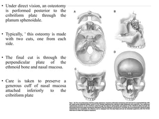 Access osteotomies in oral & cranio-maxillofacial surgery | PPTX