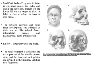 Access osteotomies in oral & cranio-maxillofacial surgery | PPT