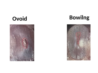 Access to cavity. Endodontic cavity preparationpptx | PPTX