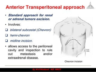 Access to urinary system v2 | PPT