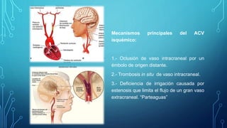 Accidente Cerebro Vascular (ACV) | PPTX