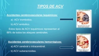 Accidente Cerebro Vascular (ACV) | PPTX