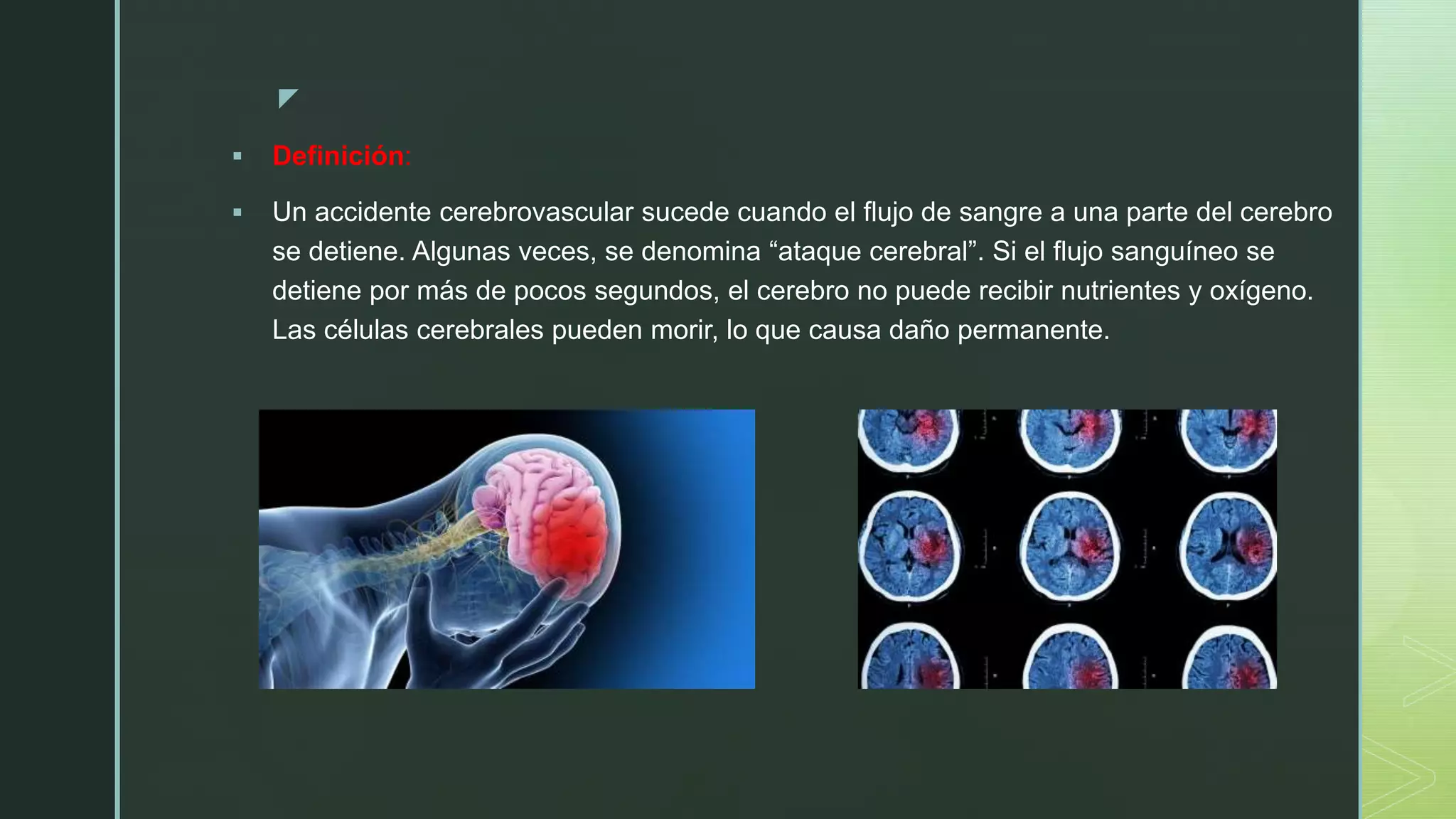 Accidente Cerebro Vascular Pptx