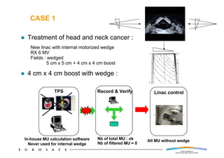 Accidents In Radiation Therapy | PDF