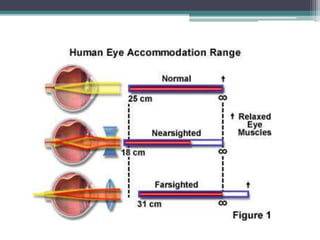 Accommodation | PPTX