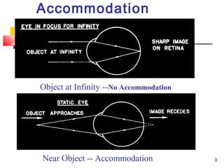 Accommodation: measurement and its anomalies | PPT