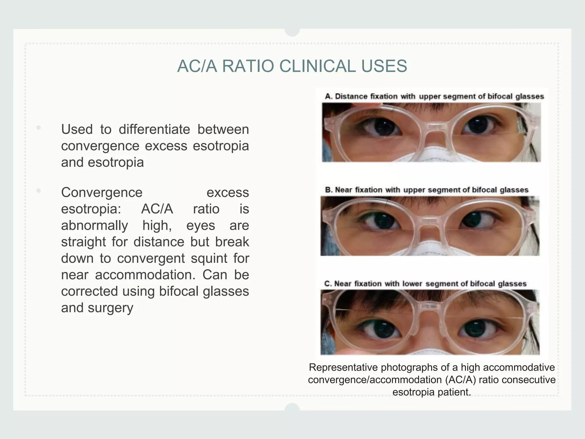 Accommodation by the eye.pptx